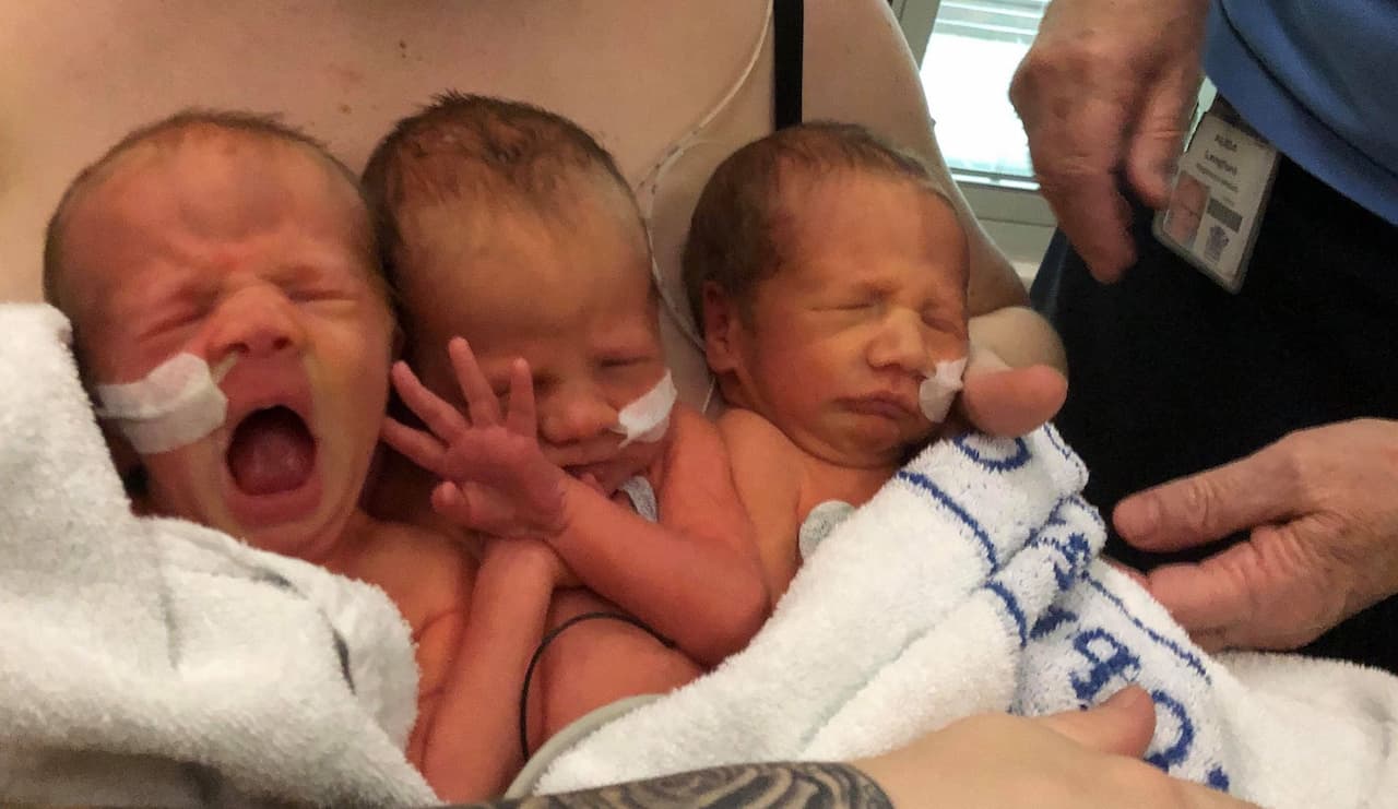 We LOVE these newborn triplets fed by Spectra